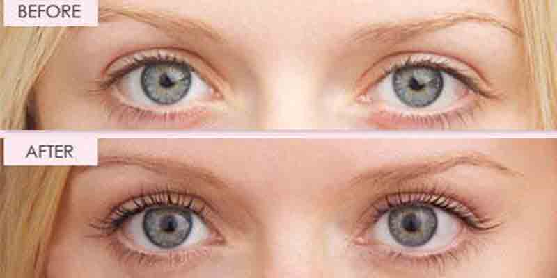 Eyelash Tinting | Beauty and Laser Clinic